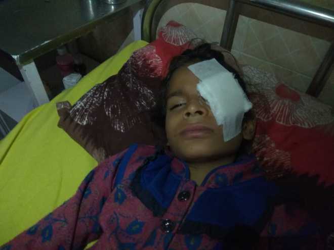 PGI, Chandigarh gets 28 cases of firecracker-related eye injuries - The ...